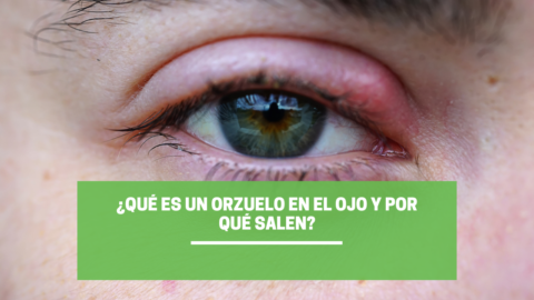 ¿Qué es un orzuelo en el ojo y por qué salen? | clinicaortuno.es